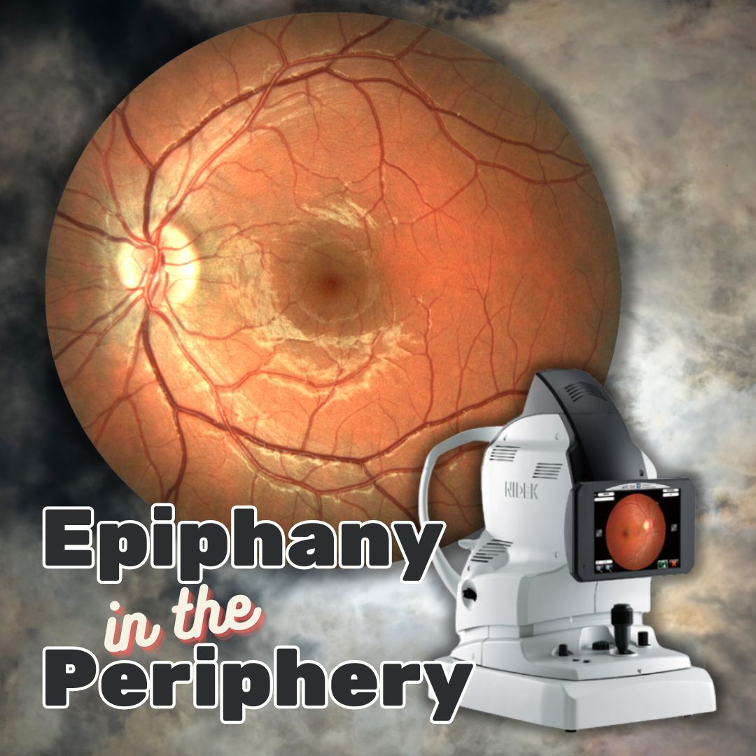 Epiphany in the Periphery | Colorado Retina Associates